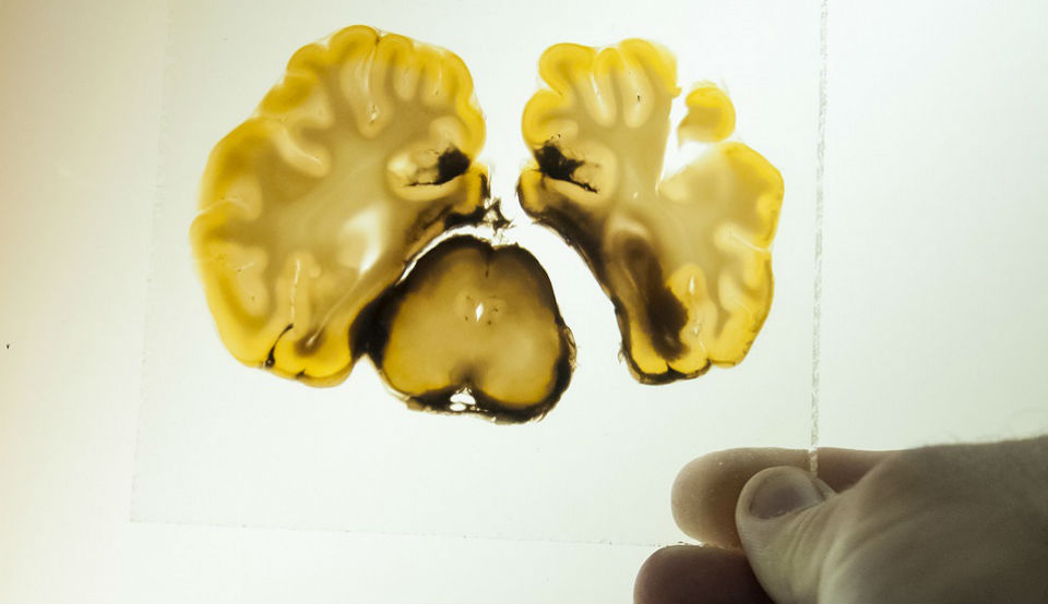 A técnica de plastinação no estudo de anatomia – Agência UFC